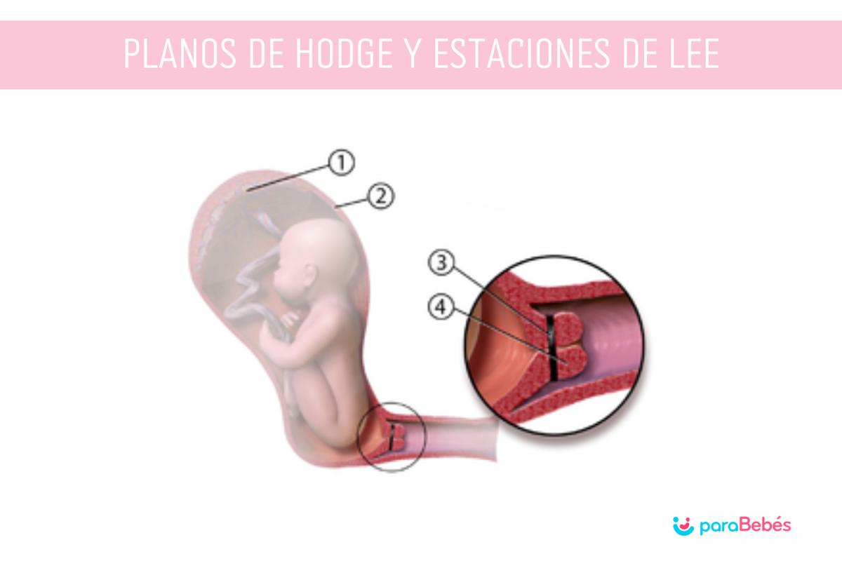 Cerclaje cervical: qué es, para qué sirve y cuándo realizarlo