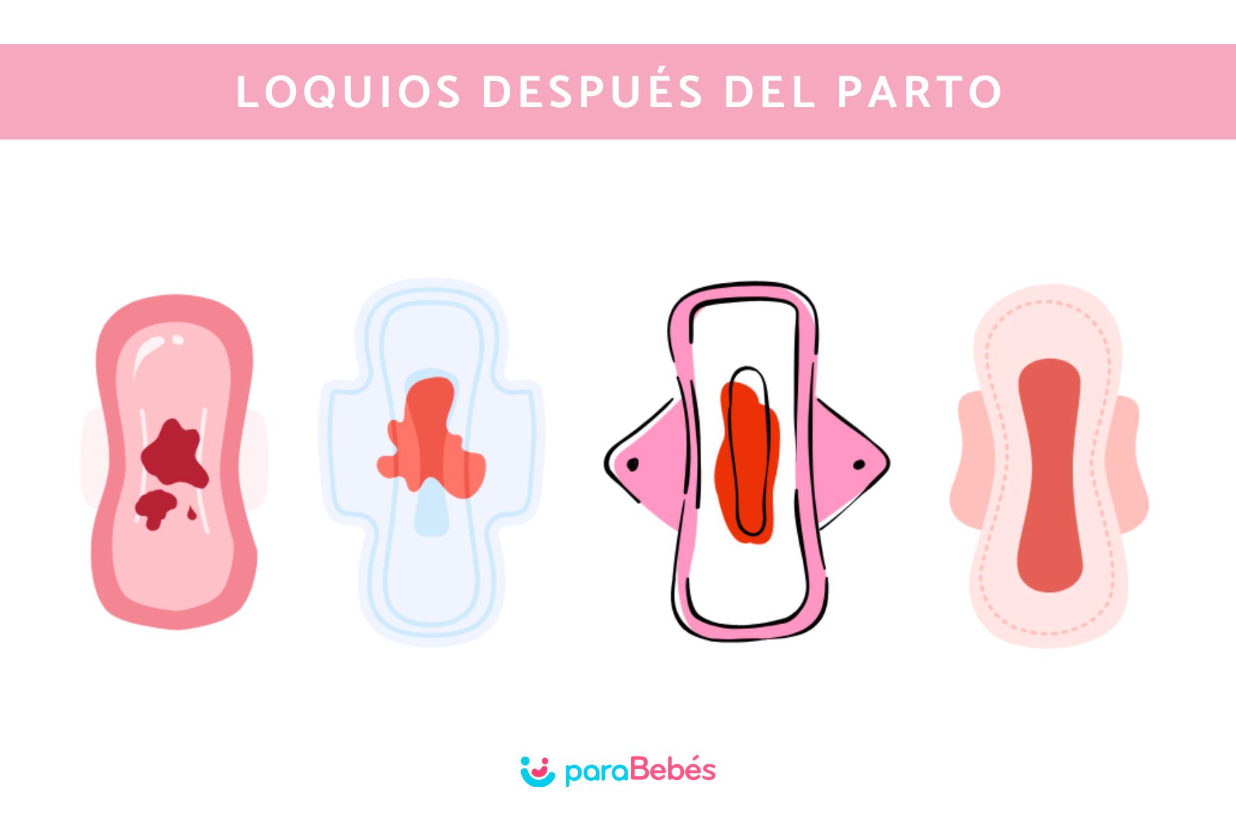 Loquios después del parto: cuidados, duración y cuándo preocuparse