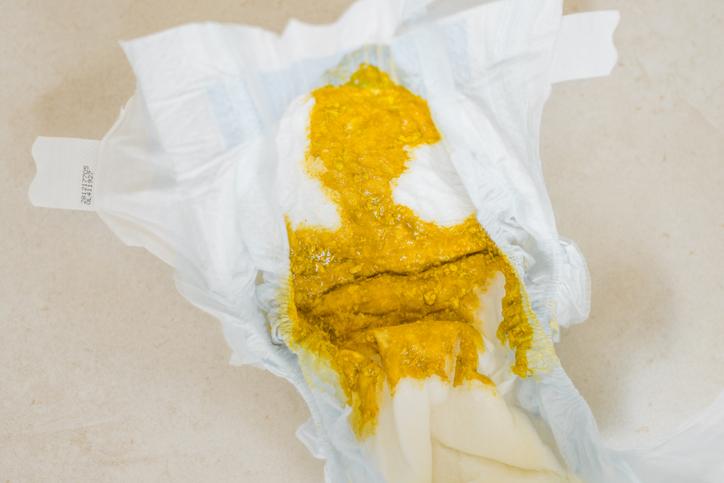 Caca verde en bebés: causas y cómo actuar
