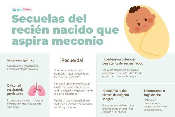 Síndrome de aspiración meconial: signos y complicaciones