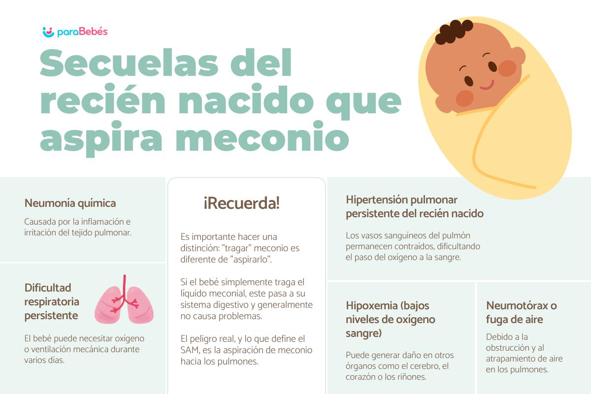 Síndrome de aspiración meconial: signos y complicaciones