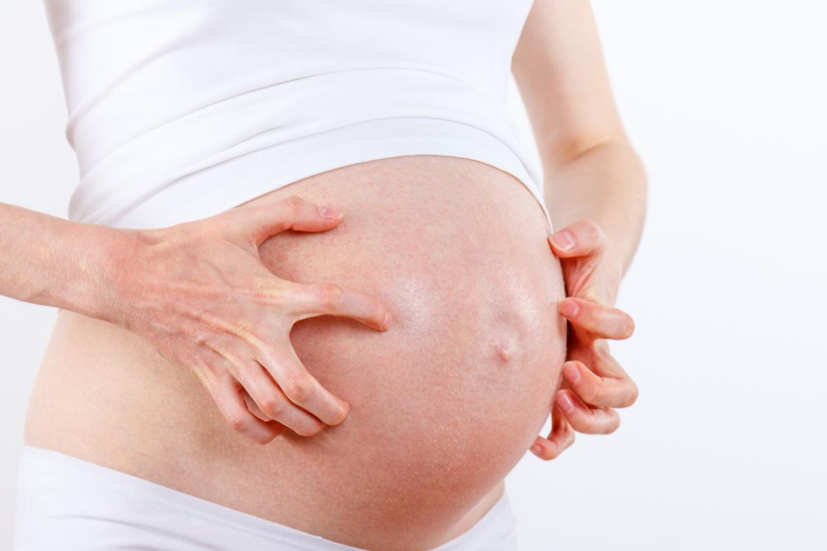 Colestasis intrahepática del embarazo: tratamiento y síntomas